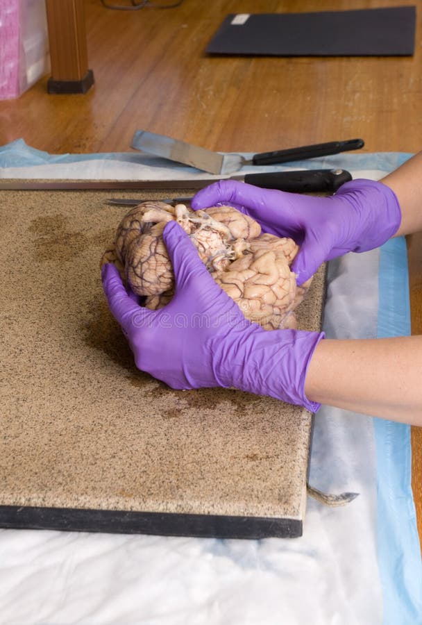 Human Brain lab tests stock photo. Image of pathology - 34000732