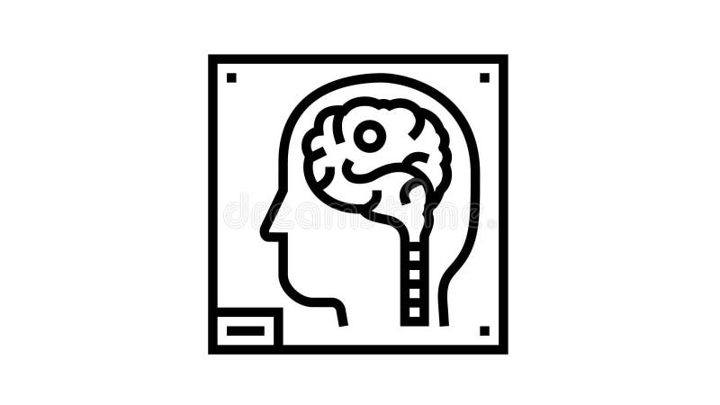 Human Brain X-ray Line Icon Animation Stock Video - Video of congestion ...