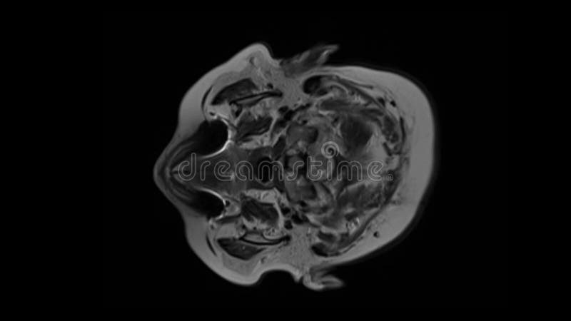 Human Brain Scan. Mri Brain Scan. Computed Tomography of the Human ... Human Brain Scan. Mri Brain Scan. Computed Tomography of the Human ...