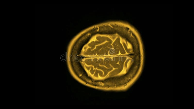 Human Brain Scan Mri Brain Scan Computed Tomography Of The Human