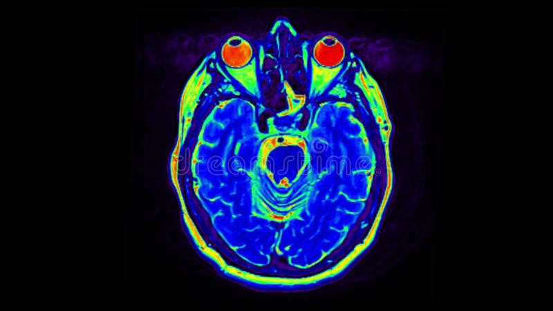 Human Brain Scan. Mri Brain Scan. Computed Tomography of the Human ... Human Brain Scan. Mri Brain Scan. Computed Tomography of the Human ...