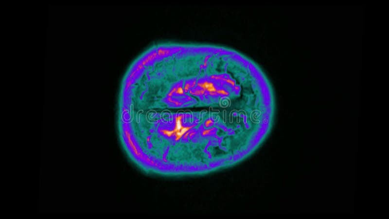 Human Brain Scan. Mri Brain Scan. Computed Tomography of the Human ... Human Brain Scan. Mri Brain Scan. Computed Tomography of the Human ...