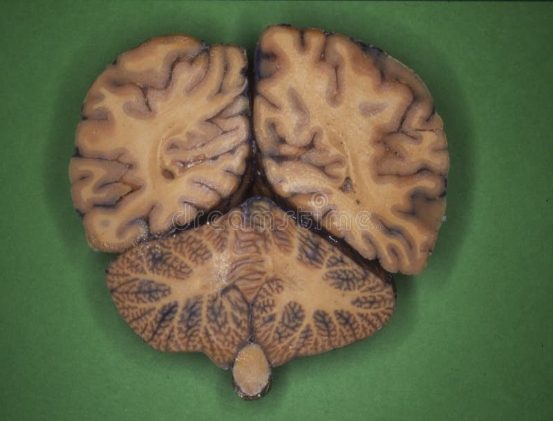 Human Brain Sliced with Nerves Stock Image - Image of brain, logik ...