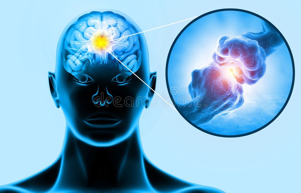 Human Brain Stimulation or Activity with Neuron Stock Image - Image of ...