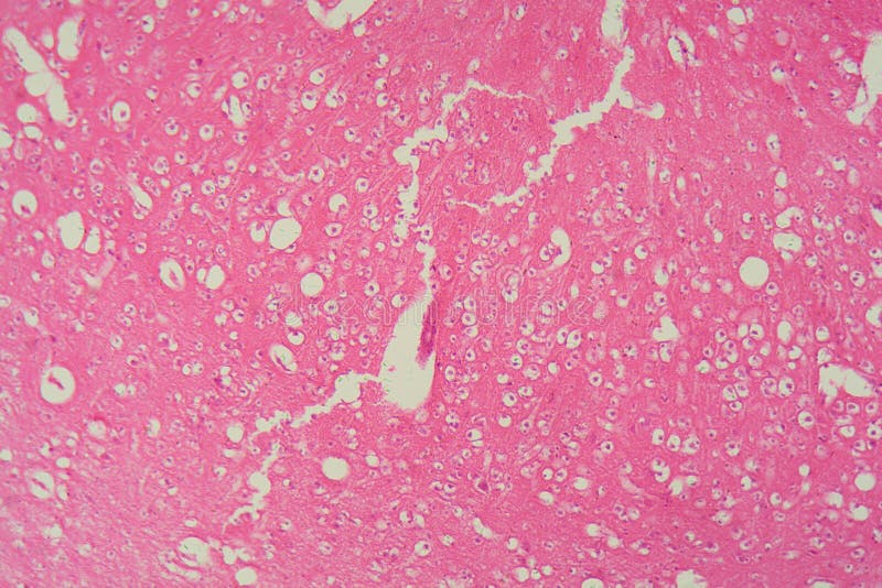 Human Brain Under the Microscope Stock Image - Image of cerebra ...