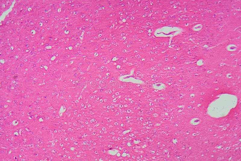 Human Brain Under the Microscope Stock Photo - Image of macro ...