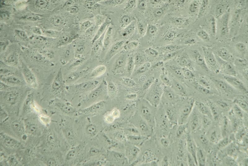 Human Cancer Cells Under Microscope Background Texture Stock Image ...