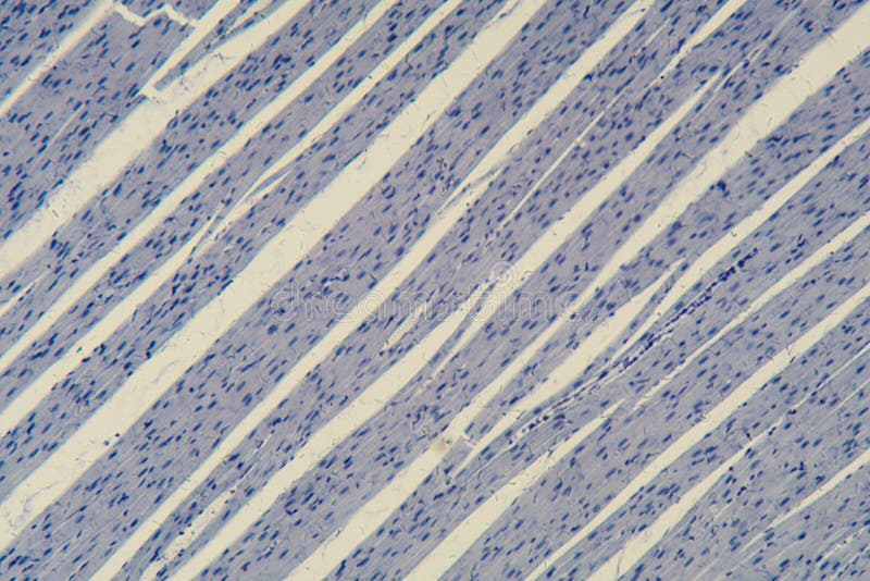 Human Cardiac Muscle Under the Microscope Stock Photo - Image of ...