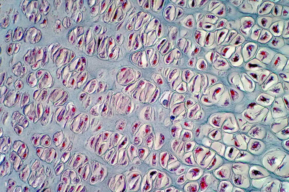 Bone Ligament Microscope Stock Photos - Free & Royalty-Free Stock ...