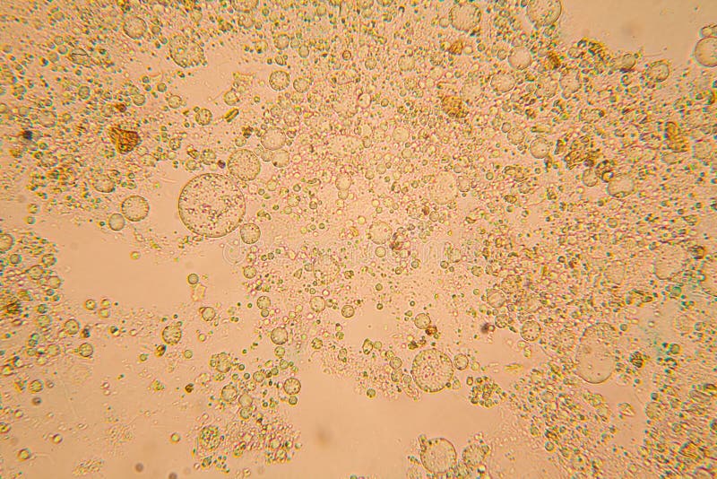 Human Cells and Water at the Microscope Stock Photo - Image of smear ...