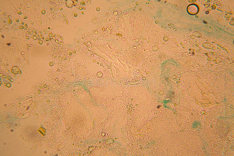 Human Cells and Water at the Microscope Stock Photo - Image of icon ...