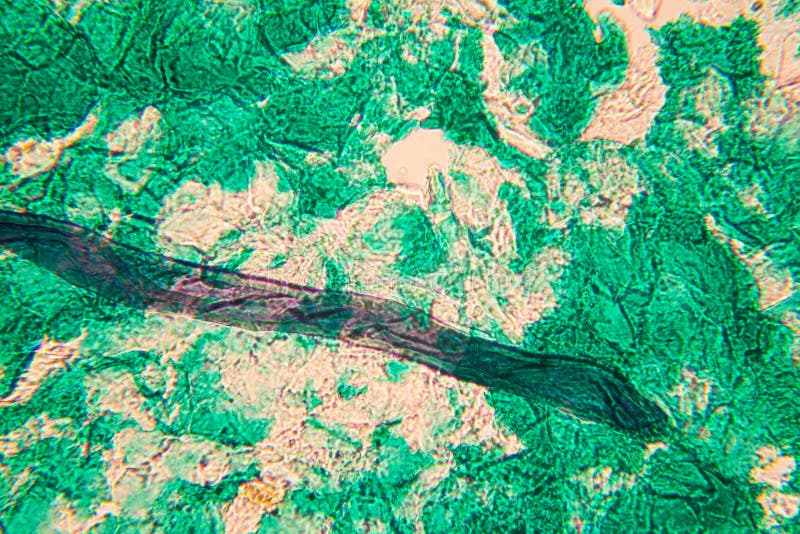 Human Cells and Water at the Microscope Stock Image - Image of medical ...