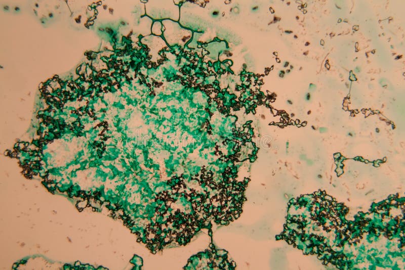 Human Cells and Water at the Microscope Stock Image - Image of ...