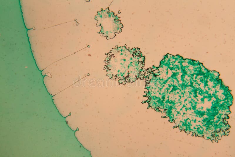 Human Cells and Water at the Microscope Stock Photo - Image of sample ...