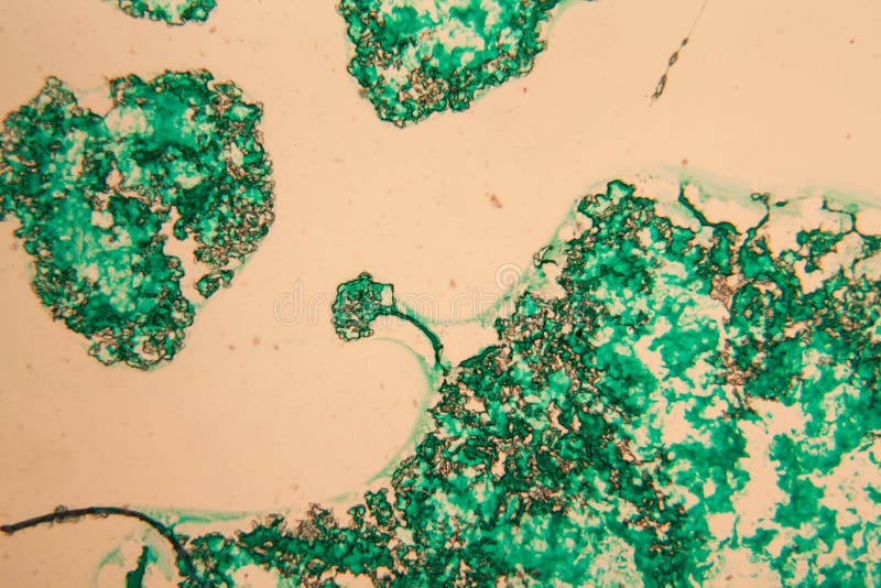 Human Cells and Water at the Microscope Stock Image - Image of ...