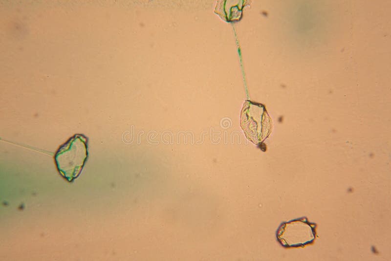 Human Cells and Dried Water at the Microscope Stock Image - Image of ...