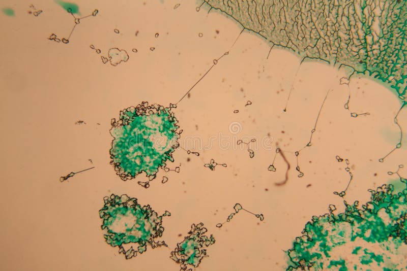Human Cells and Water at the Microscope Stock Photo - Image of medicine ...