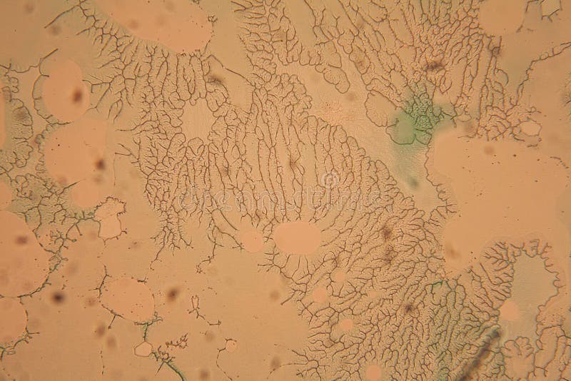 Human Cells and Water at the Microscope Stock Photo - Image of skin ...