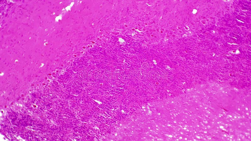 Motor Cortex Section of Human Being Magnified Under Microscope 40 on ...