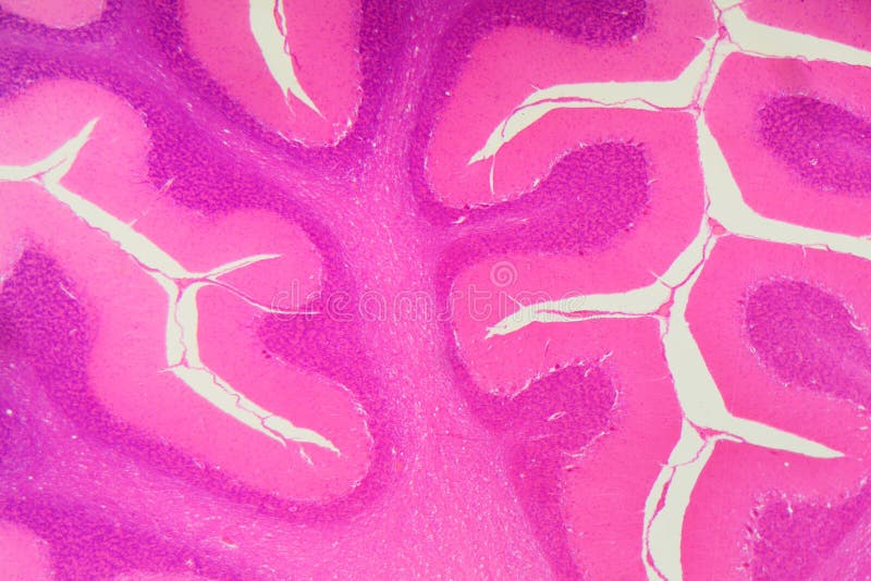 Human Cerebellum Under the Microscope Stock Photo - Image of medicals ...