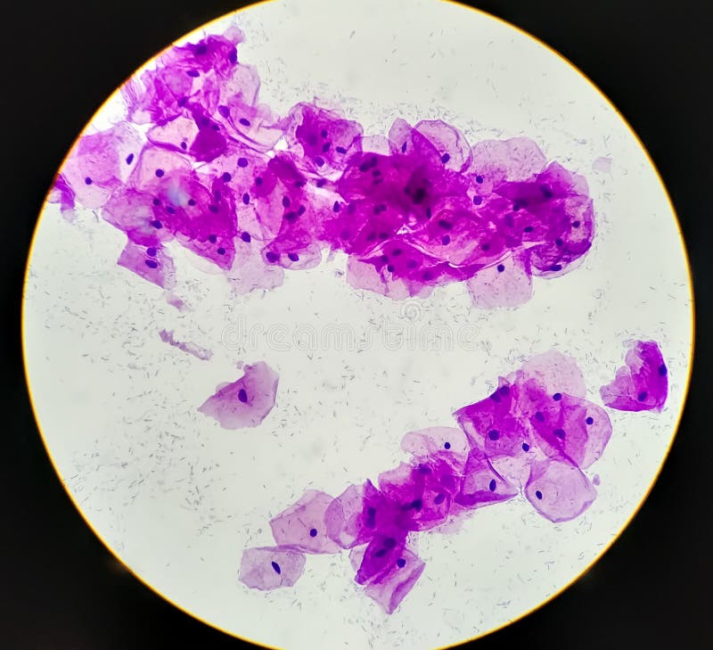 Human Cheek Epithelial Cells. Stock Image - Image of composed, magenta ... Human Cheek Epithelial Cells. Stock Image - Image of composed, magenta ...