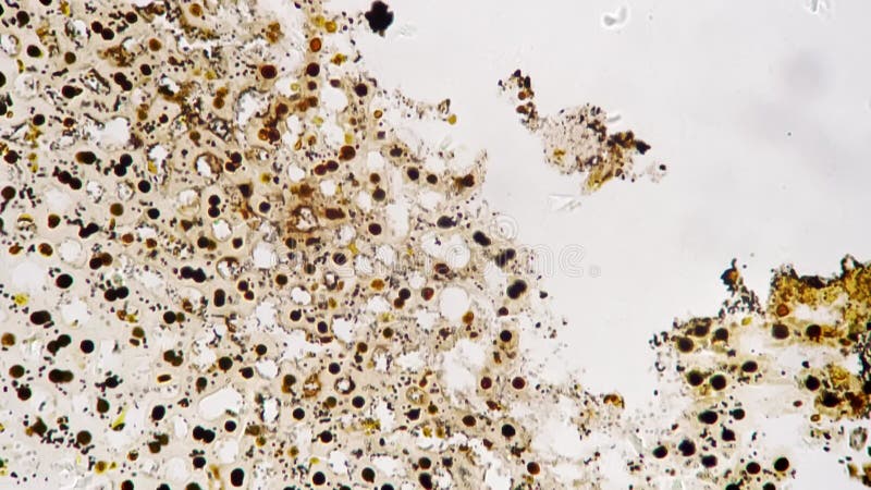 Human Cholangiole in Section Under Microscope with 400x Magnification ...