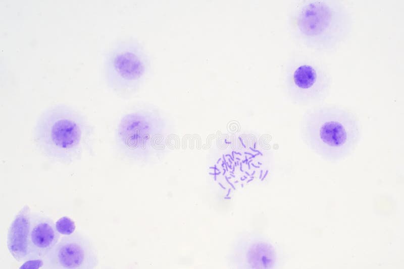 Human Chromosomes Under Light Microscope. 1000x Magnification Stock ...