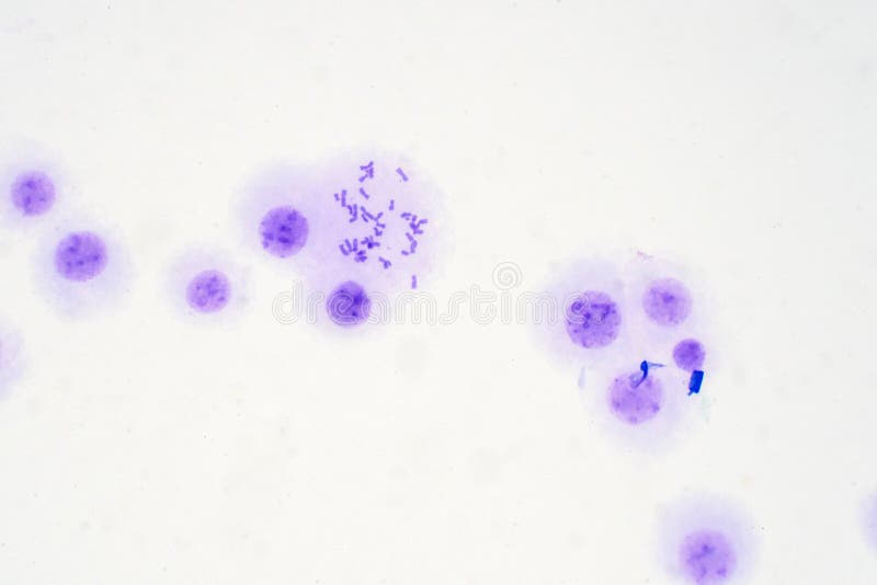 Human Chromosomes Under Microscope View Stock Image - Image of ...
