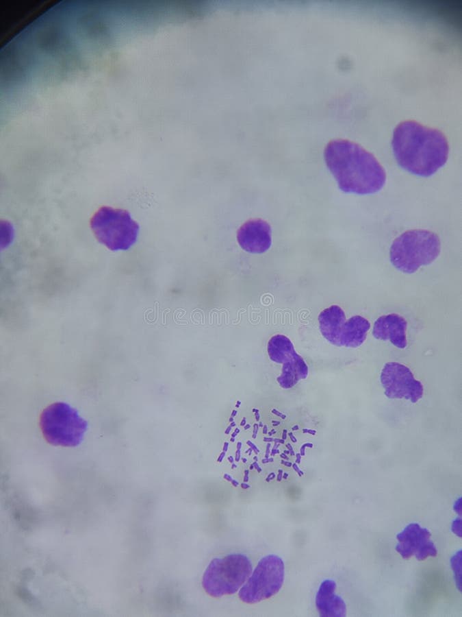 Human Chromosomes Under the Microscope Stock Image - Image of pattern ...