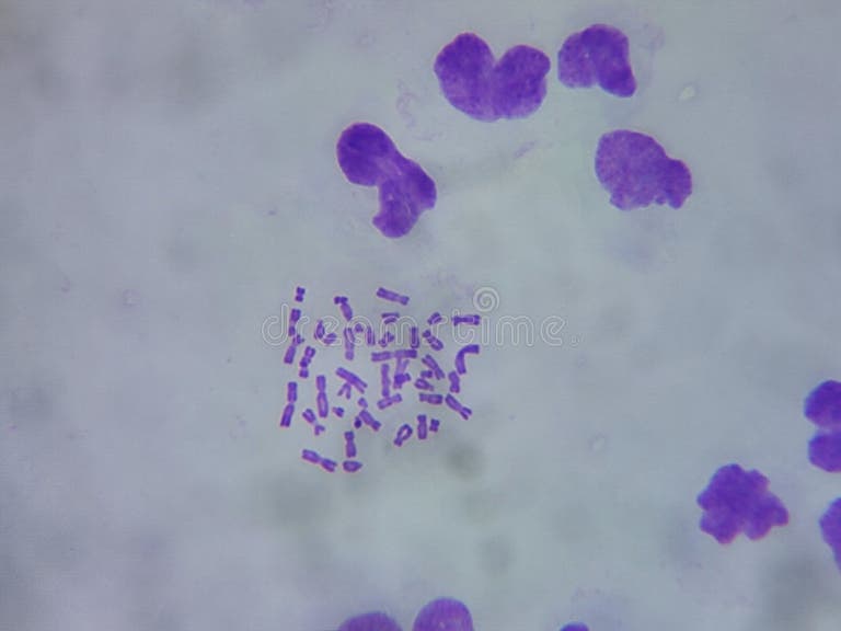 Human Chromosomes Under the Microscope Stock Photo - Image of text ...