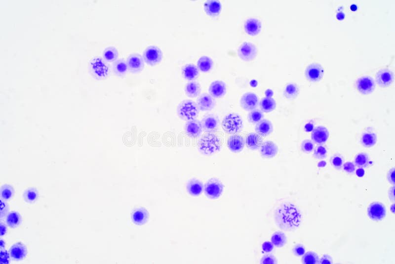 Human Chromosomes Under Microscope View Stock Image - Image of ...