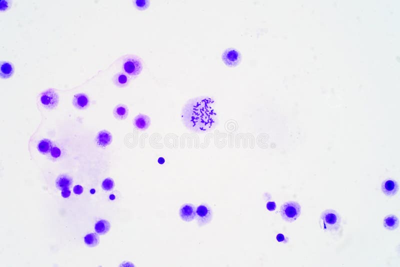 Human Chromosomes Under Light Microscope. 1000x Magnification Stock ...