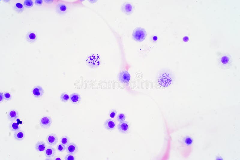 Human Chromosomes Under Light Microscope. 1000x Magnification Stock ...