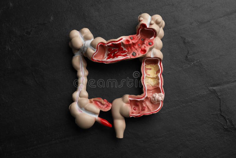 Human Colon Model on Black, Top View Stock Image - Image of department ...