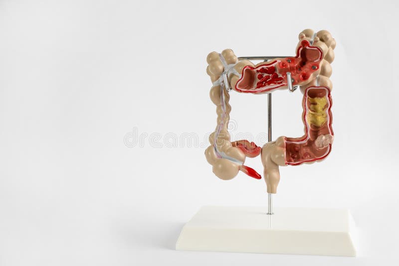 Human Colon Model on Blue Background. Space for Text Stock Photo ...