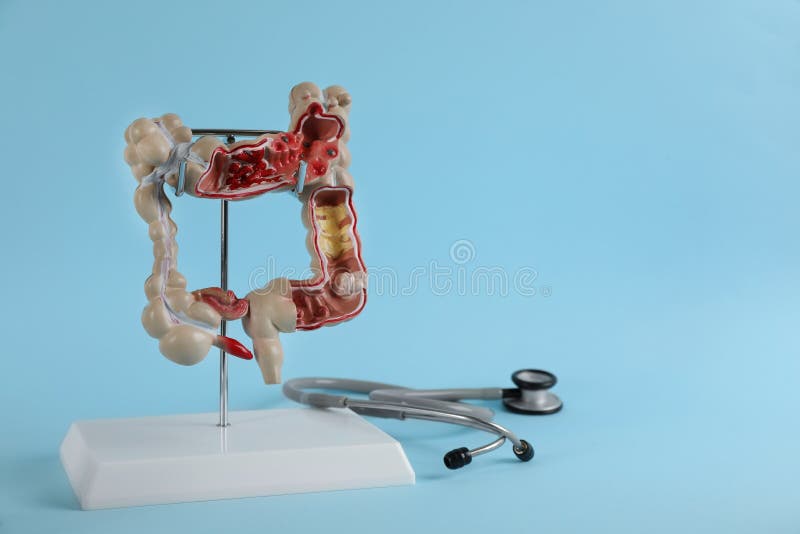 Human Colon Model on Blue Background. Space for Text Stock Photo ...