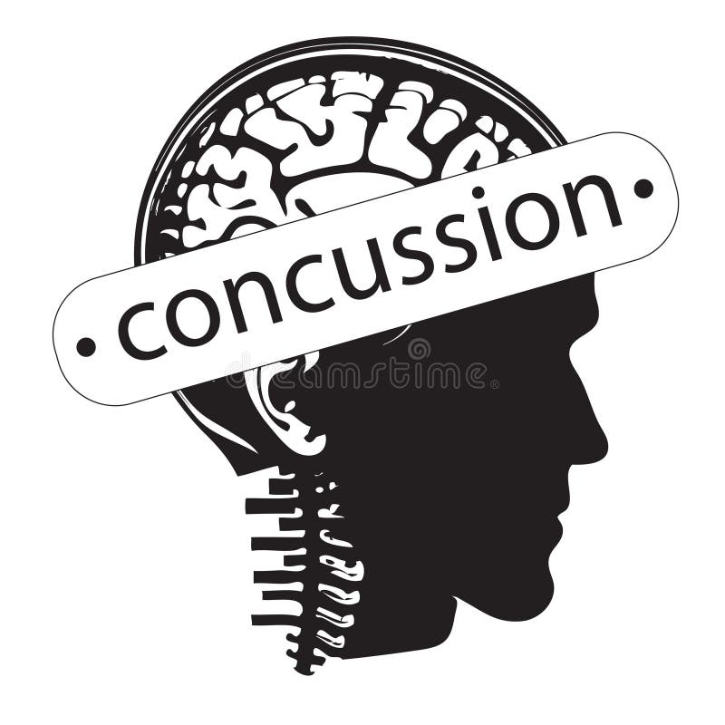 Human concussion symbol stock illustration. Illustration of white ...