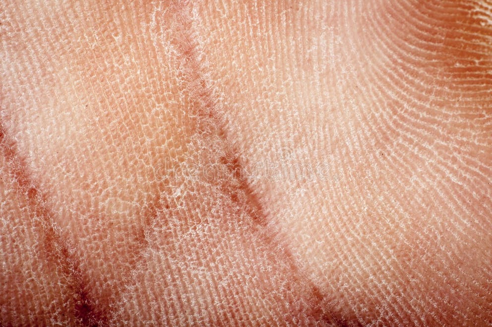 Human dried skin stock photo. Image of close, attractive - 28337236