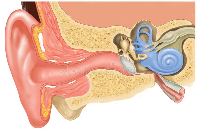 Spinal Canal Stenosis. Lumbar Vertebra with Intervertebral Disc and ...
