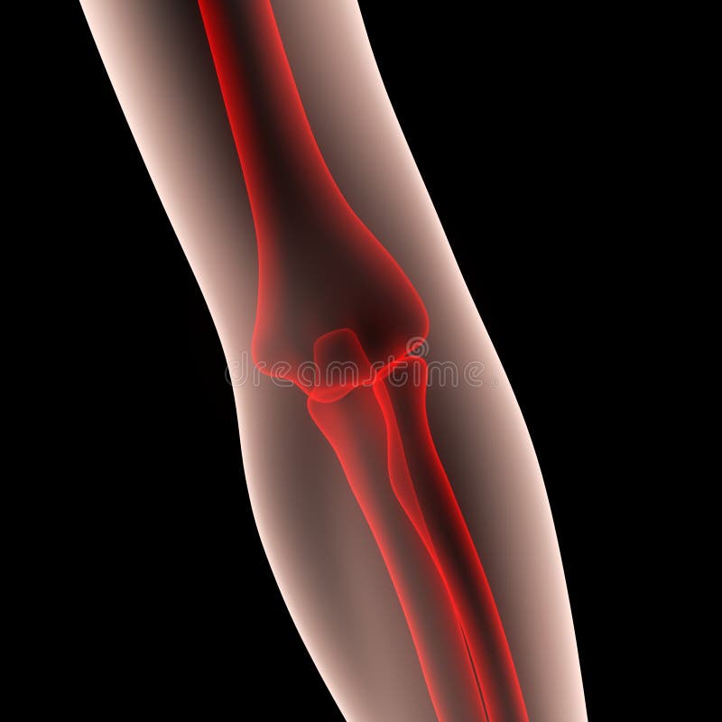 Human Elbow Joint stock illustration. Illustration of osteoporosis ...