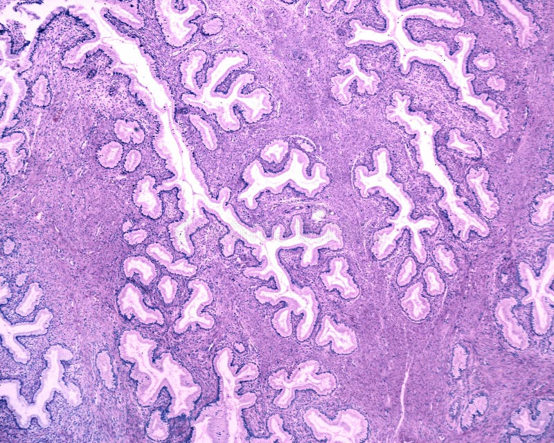 Human Endocervix. Endocervical Glands Stock Image - Image of histology ...