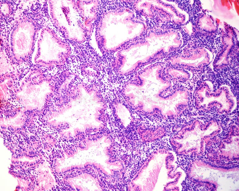 Histology Of The Human Endometrium During The Normal Cycle Ovary And