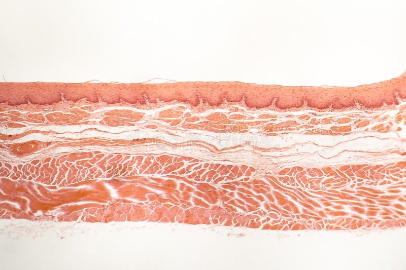 Human esophagous mucosa stock photo. Image of human, esophagous - 78879154