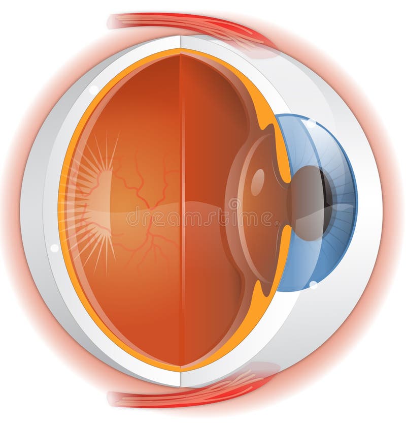 Human Eye - Retinal Detachment Stock Illustration - Illustration of ...
