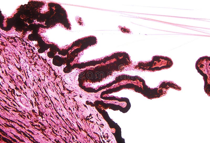 Human eye. Ciliary body stock image. Image of aqueous - 303600529