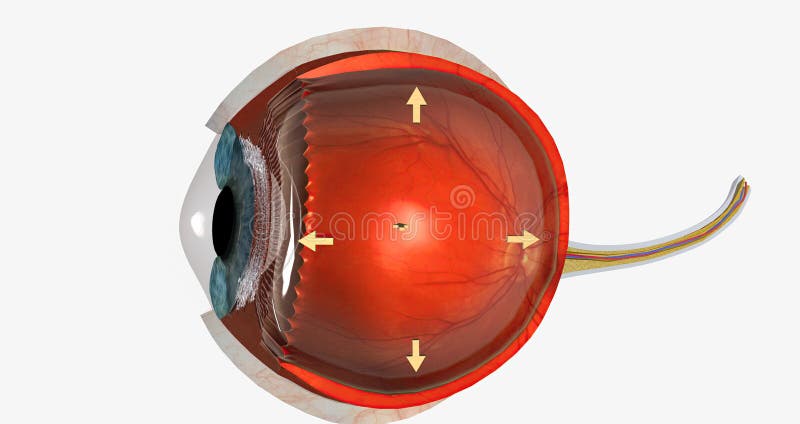 Human Eye - Glaucoma (eye Disease Stock Illustration - Illustration of ...