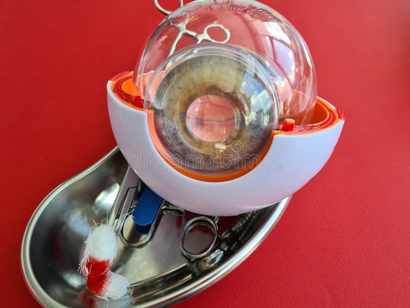 Human Eye Model Operation and Surgery Concept Stock Photo - Image of ...