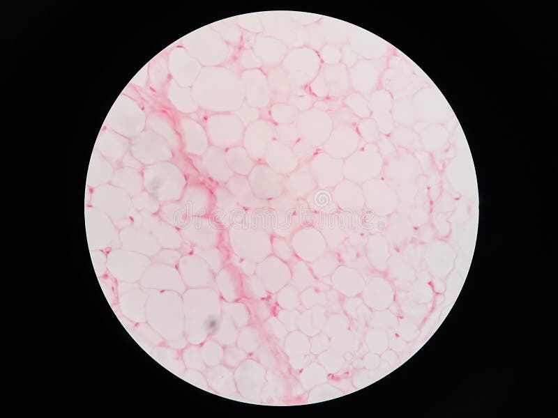 Human Fat Body Tissue Under Microscope View Stock Image - Image of ...