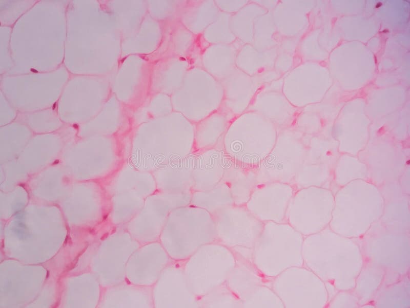 Human fat body tissue stock photo. Image of loss, cellular - 89484354