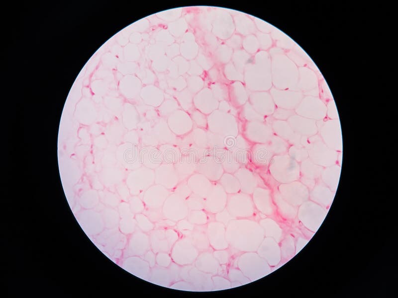 Human fat body tissue stock illustration. Illustration of dermis - 89484379